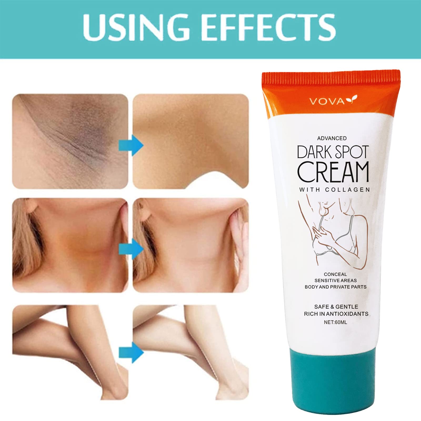 ROUSHUN Underarm Cream, Body Cream - Nourishes Moisturizes Underarm, Neck, Knees, Elbows, Between Legs 2 fl.oz