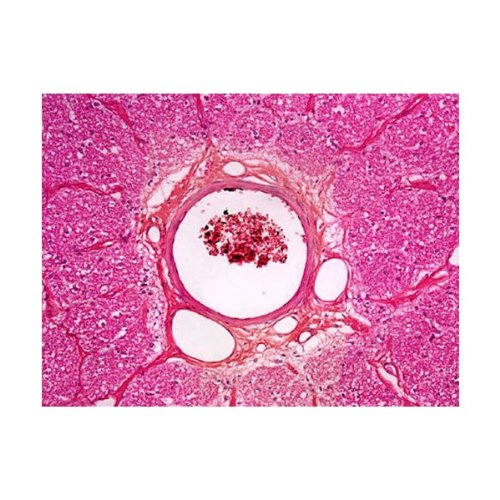 AmScope PS100A Prepared Microscope Slide Set for Basic Biological Science Education, 100 Slides, Set A, Includes Fitted Wooden Case