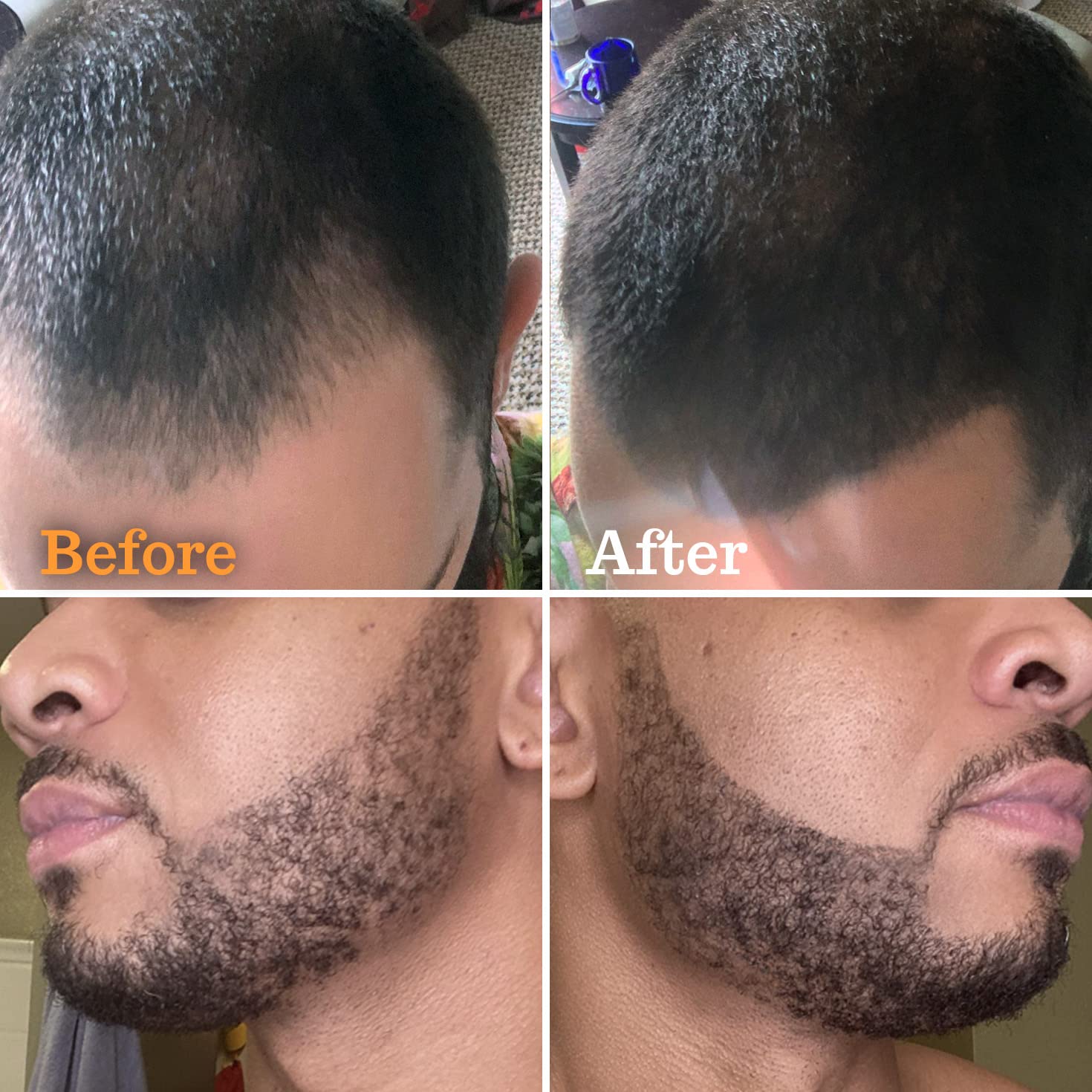 Beard Pen Filler for Men - Barber Styling Grooming Pencil - Waterproof Proof, Sweat Proof, Long Lasting Solution with Natural Finish - Cover Beard and Scalp Patches in Seconds - Jet Black 1 Pack