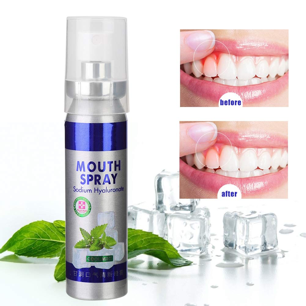 Ultra fine Mouth Spray, Breath Freshener Spray 2 x 2 x 9.7cm Nutrient Ingredients Liquid,Mint Flavor Breath Refreshing Mouth Spray Bad Breath Removal Oral Spray 20ml