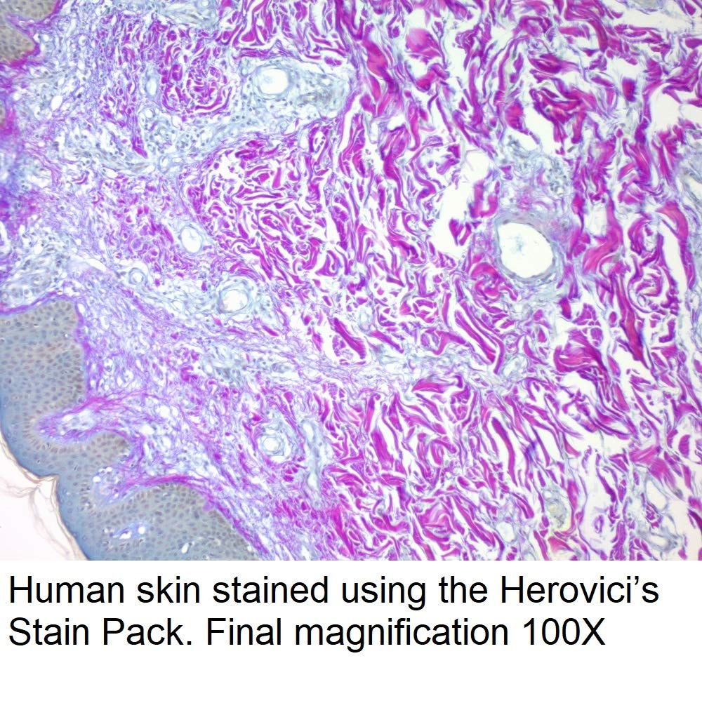Herovici's Stain Pack, 500ml