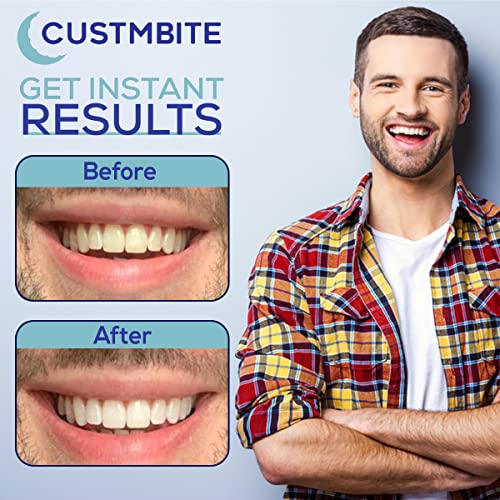 CustMbite Premium Teeth Whitening Gel Applicator, 16% Carbamide Peroxide, (5) 3ml Applicators