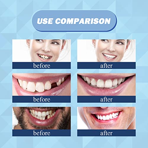 30 ml Tooth Repair Kit, Temporary Teeth Replacement Kit - Moldable Thermal Fitting Beads for Filling Fix Missing and Broken Tooth or Adhesive Denture Fake Teeth