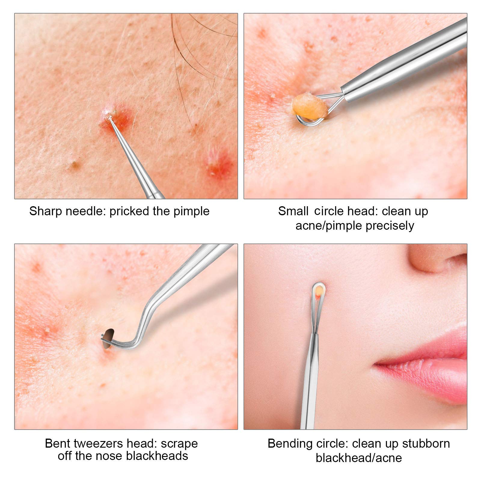 Blackhead Remover Tools, 7Pcs Pimple Acne Blemish Removal Tools Set Zit Extractor with Tin Case by JAZZZNAP, Silver
