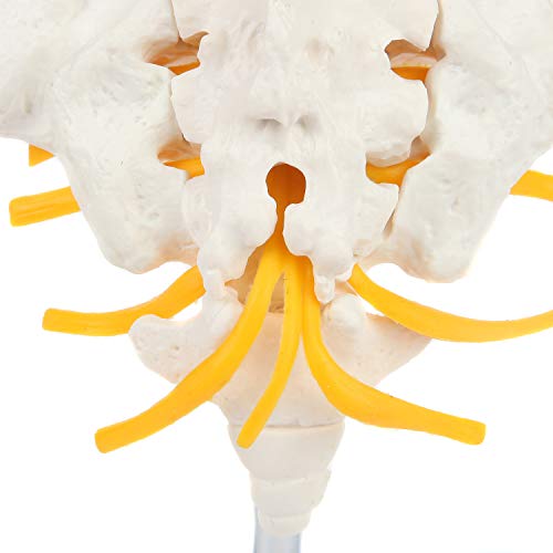 Axis Scientific Lumbar Spine Anatomy Model with Sacrum and Spinal Nerves, Lumbar Vertebrae, Vertebral Model, Spinal Model Didactic Replica of Lumbrosacral Section with Nerves, Herniated Disc at L4, Includes Base for Display