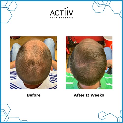 ACTIIV Recover Thickening Cleansing Hair Loss Shampoo Treatment for Men, 7 Fl oz (Packaging May Vary)