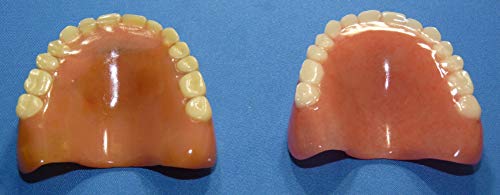 Denture Repair Lab - Duplicate Denture - Denture Clone - Denture Duplication - New Denture - Copy Denture - Spare Denture - Denture Clone - Denture Teeth Repair