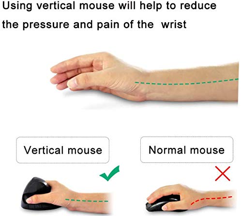 2.4G Wireless Ergonomic Vertical Mouse 800/1200 / 1600DPI, 5 Buttons (Purple)