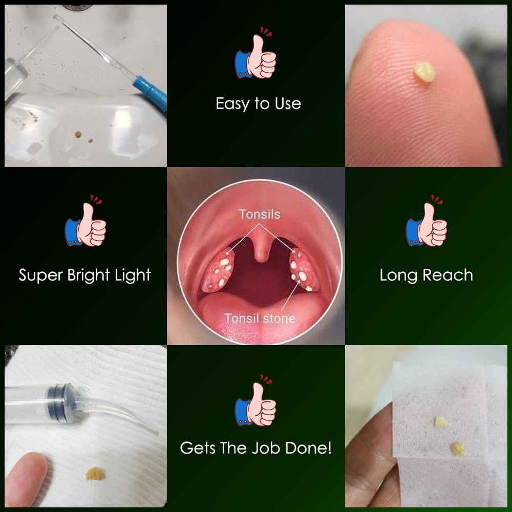 Airgoesin Upgraded 2 Lighted Tonsil Stone Remove Tool Tonsillolith Pick + Irrigation Clean Syringe Fresh Breath Oral Rinse