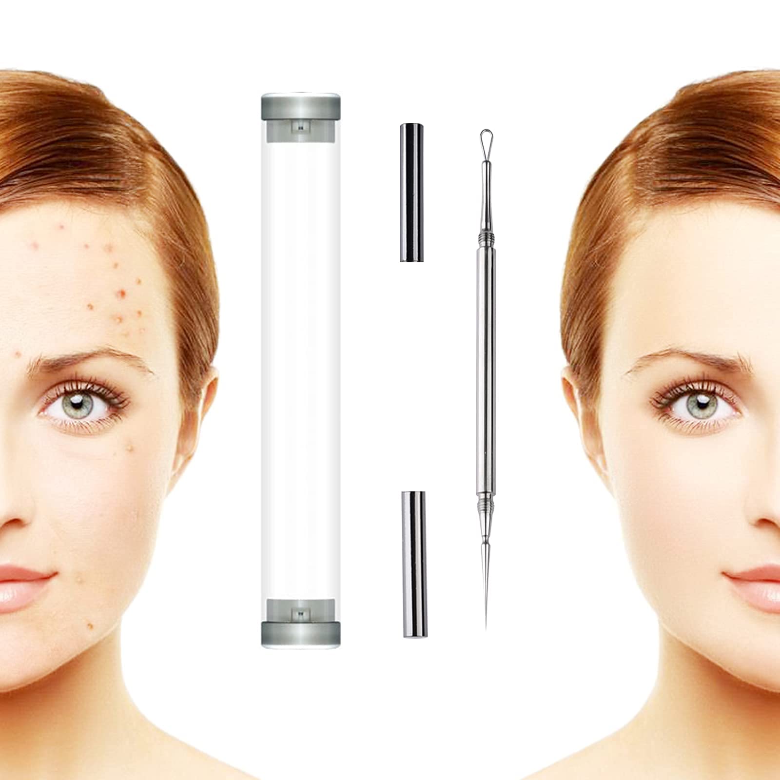 Professional Facial Milia Removal and Whitehead Extractor & Lancet - Double Ended Circle Loop & Sharp Needle Pimple Popper Tool - 2-in-1 Blackhead & Blemish Remover - Zit and Pimple Acne Removal