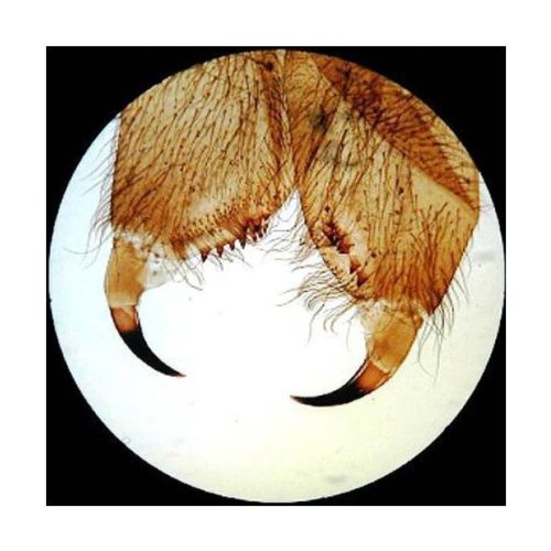 AmScope PS50A Prepared Microscope Slide Set for Basic Biological Science Education, 50 Biology and Pathology Slides, Includes Fitted Wooden Case