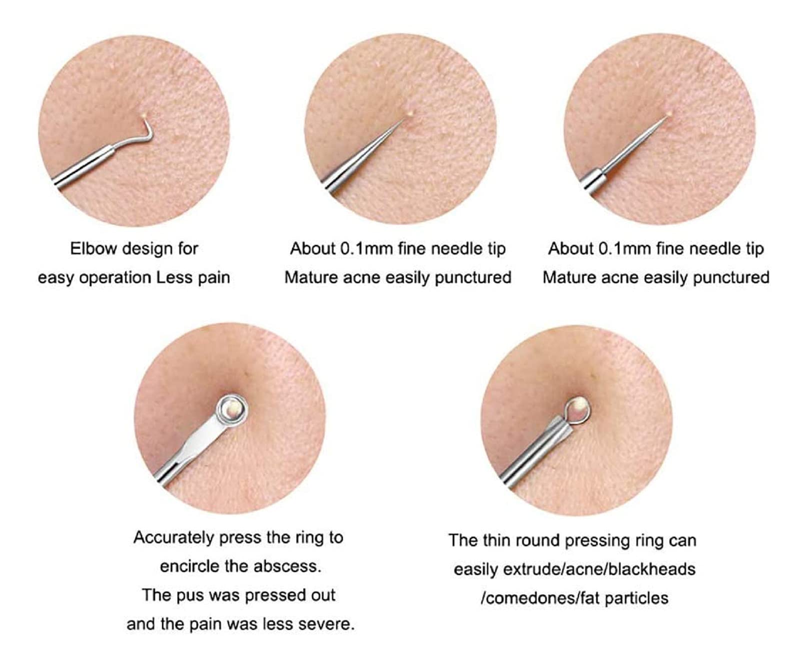 Blackhead Remover Pimple Comedone Extractor Tool Acne Kit - Treatment for Blemish, Whitehead Popping, Zit Removing for Risk Free Nose Face Skin (Sliver)