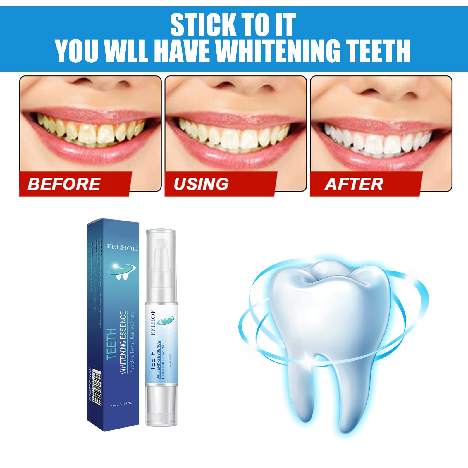 2Pcs LANTHOME Teeth Whitening Essence, Teeth Whitening Essence Pen Lanthome, Teeth Stain Remover to Whiten Teeth, Teeth Whitening Gel, Fast and Effective Removal Tooth Stain Removal