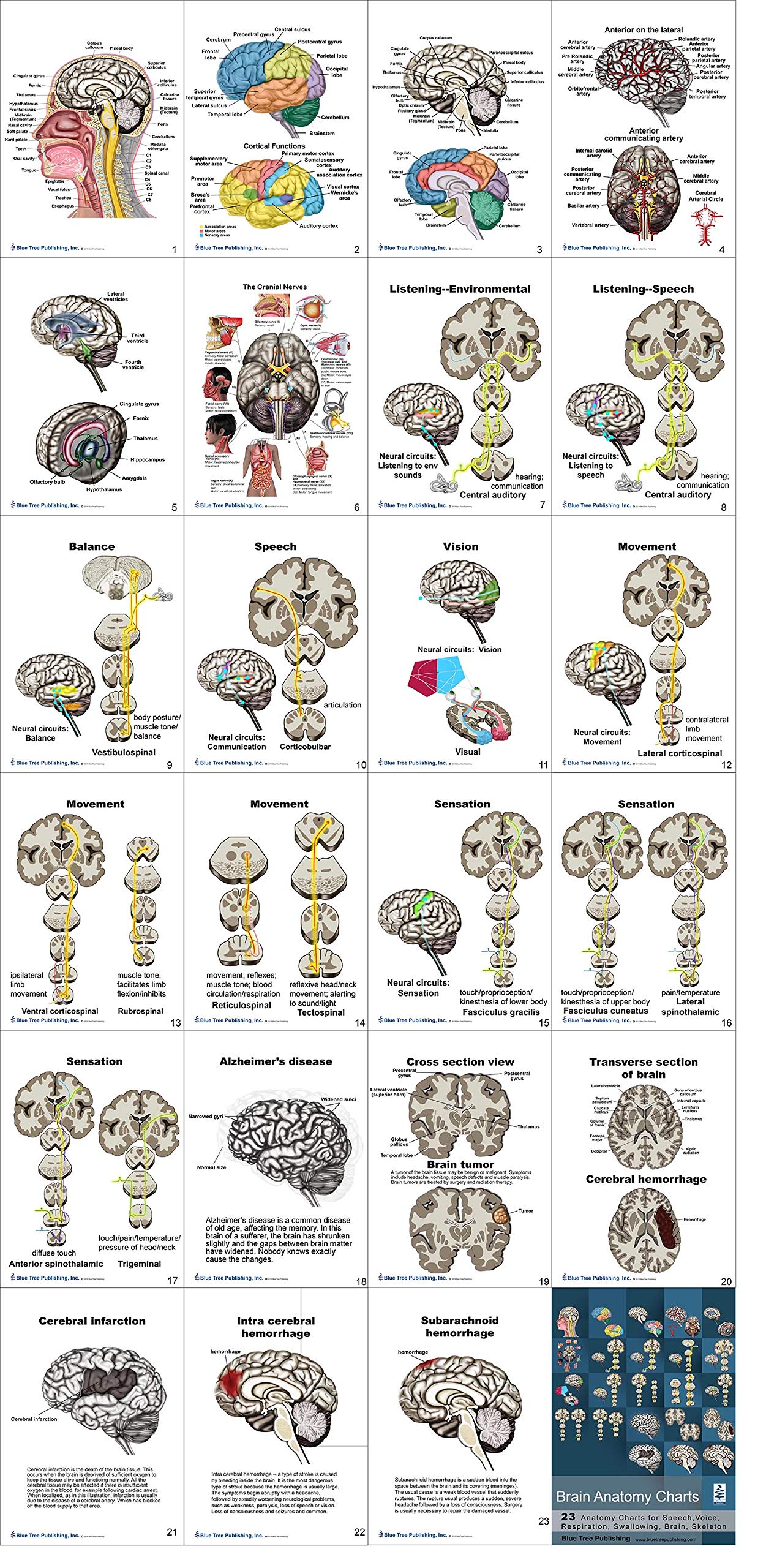 Brain Flip Charts