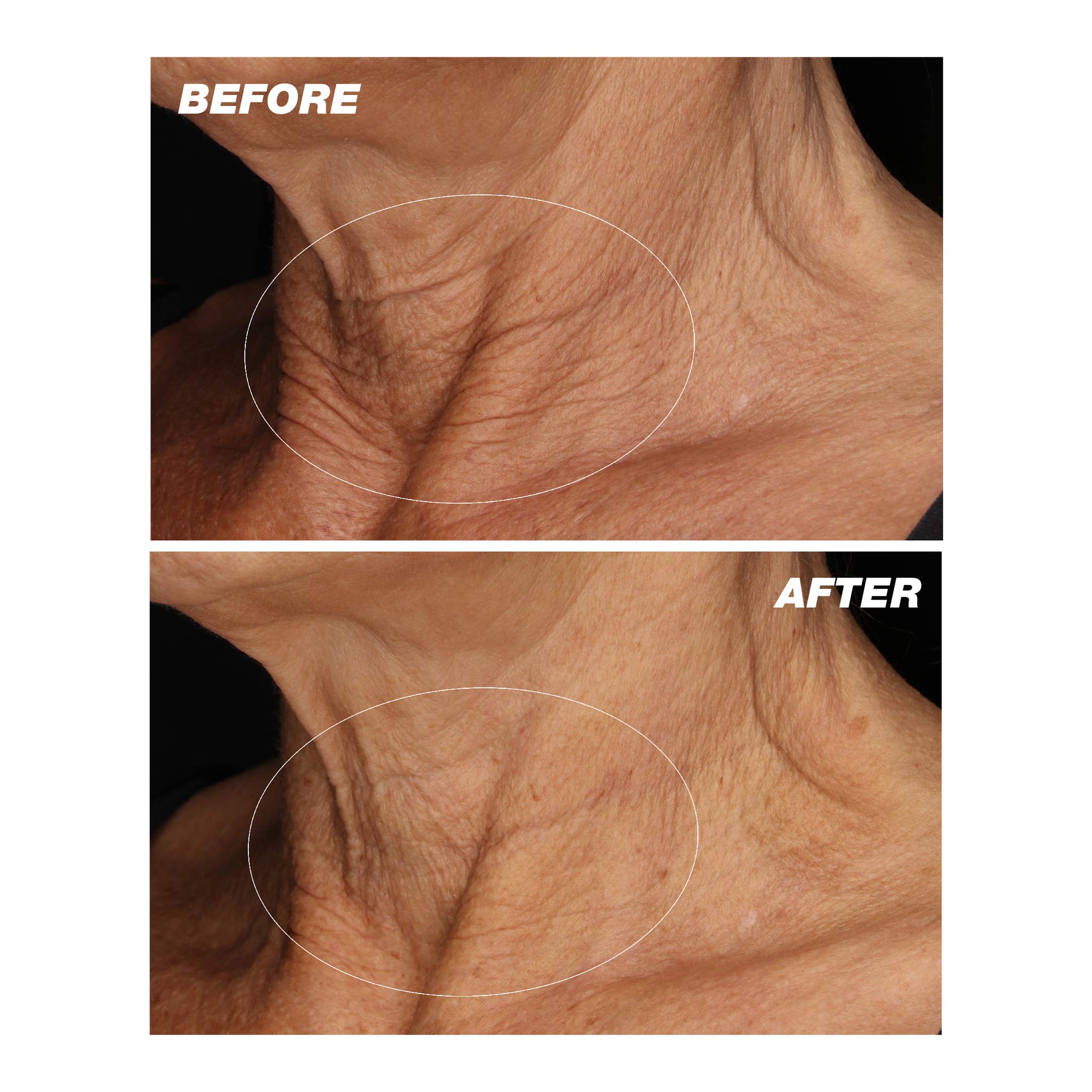 Dermalogica Neck Fit Contour Serum (1.7 Fl Oz) Lightweight Roll-On Firming Serum - Tighten Skin and Tone Over Time For Visibly Sculpted Appearance