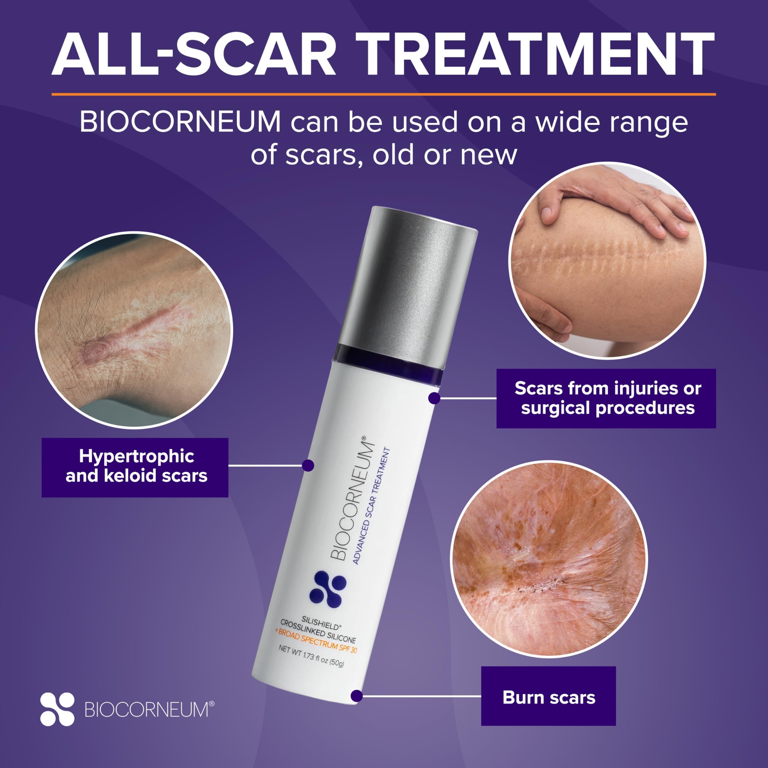 Advanced Scar Treatment with Silishield® & SPF 30 20g – Made in The USA, Fast-Drying, Water-Resistant Silicone Scar Gel - Surgeon Recommended for New & Old Scars - Suitable for Children Over 6 Months