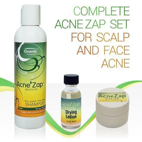 Acne Zap - Shampoo for Scalp Acne – Clear Scalp from Acne, Zits and Pimples 6.0 oz