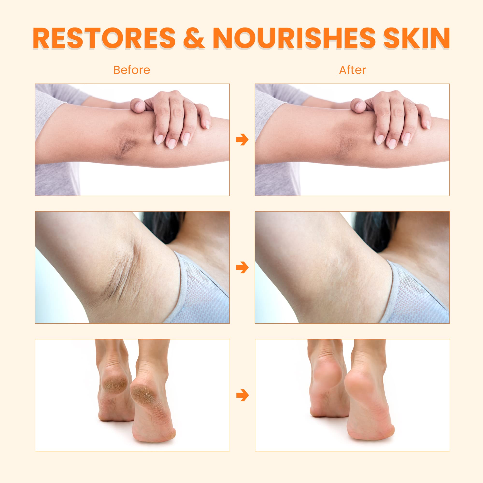 Dark Spot Cream, Brightening Cream, Underarm Cream for Armpit, Skin, Body, Elbows, Knees, Neck, Private Areas