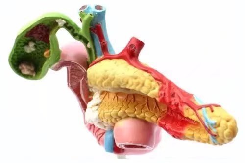 BoNew Human Duodenum Gall Bladder Disease Anatomy Medical Model Life Size