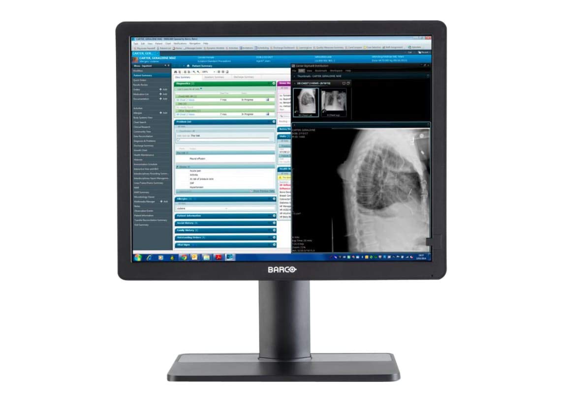 BARCO LED Monitor - 2MP - Color - 21.3" - 1600 x 1200 UXGA - 500 cd/m_ - 1800:1-8 ms - DVI-I, DisplayPort - Black, RAL 9004