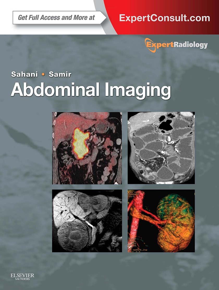 Abdominal Imaging, 2-Volume Set: Expert Radiology Series (Expert Consult: Online and Print)