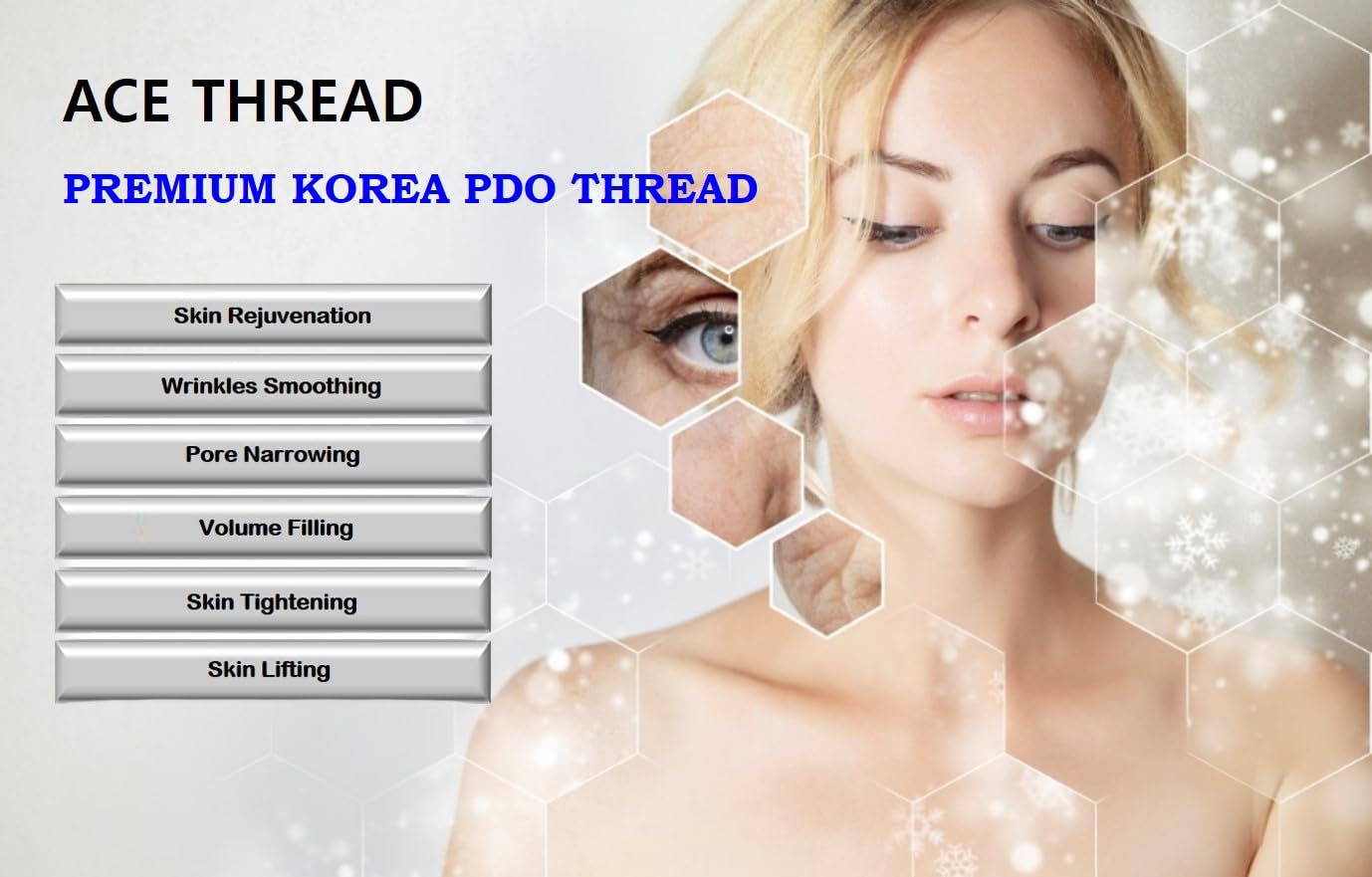 ACE - Multi Thread/L Cannular PDO thread for Forehead/Nose/Nasolabial Folds (23G38/50mm)
