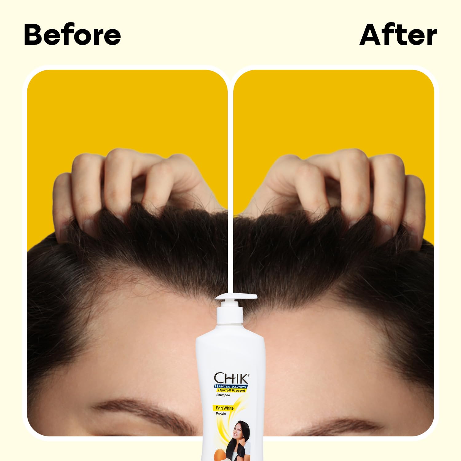 Chik Hairfall Prevent Egg Shampoo, 340ml