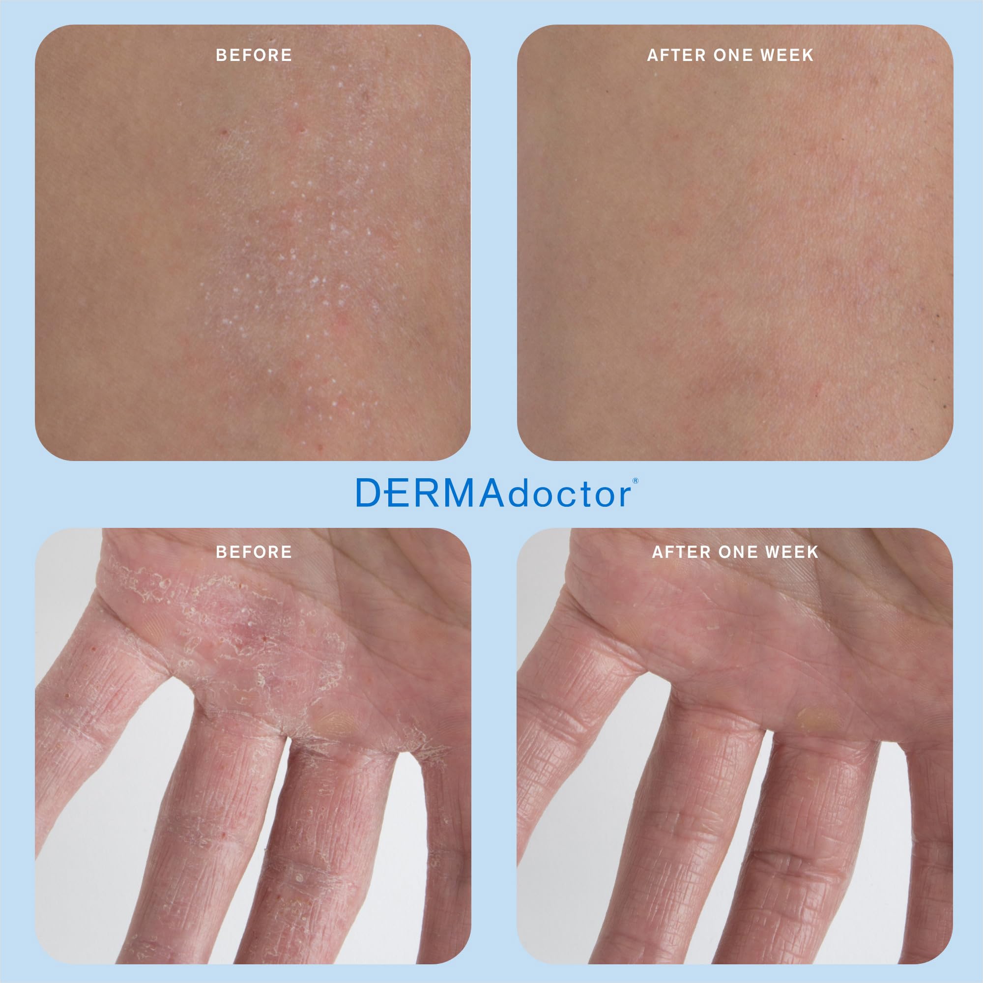 DERMAdoctor Calm Cool + Corrected Clinical Hydra Repair Cream for Face and Body with 1% Colloidal Oatmeal, Moisturizing Skin Repair for Dry, Eczema & Dermatitis Relief + Anti Itch - 6 oz