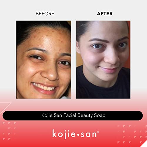 Kojie San Skin and Body Soap – Original Kojic Acid, Dark Spot Remover Soap Bar with Coconut & Tea Tree Oil – 3 x 65g Bars