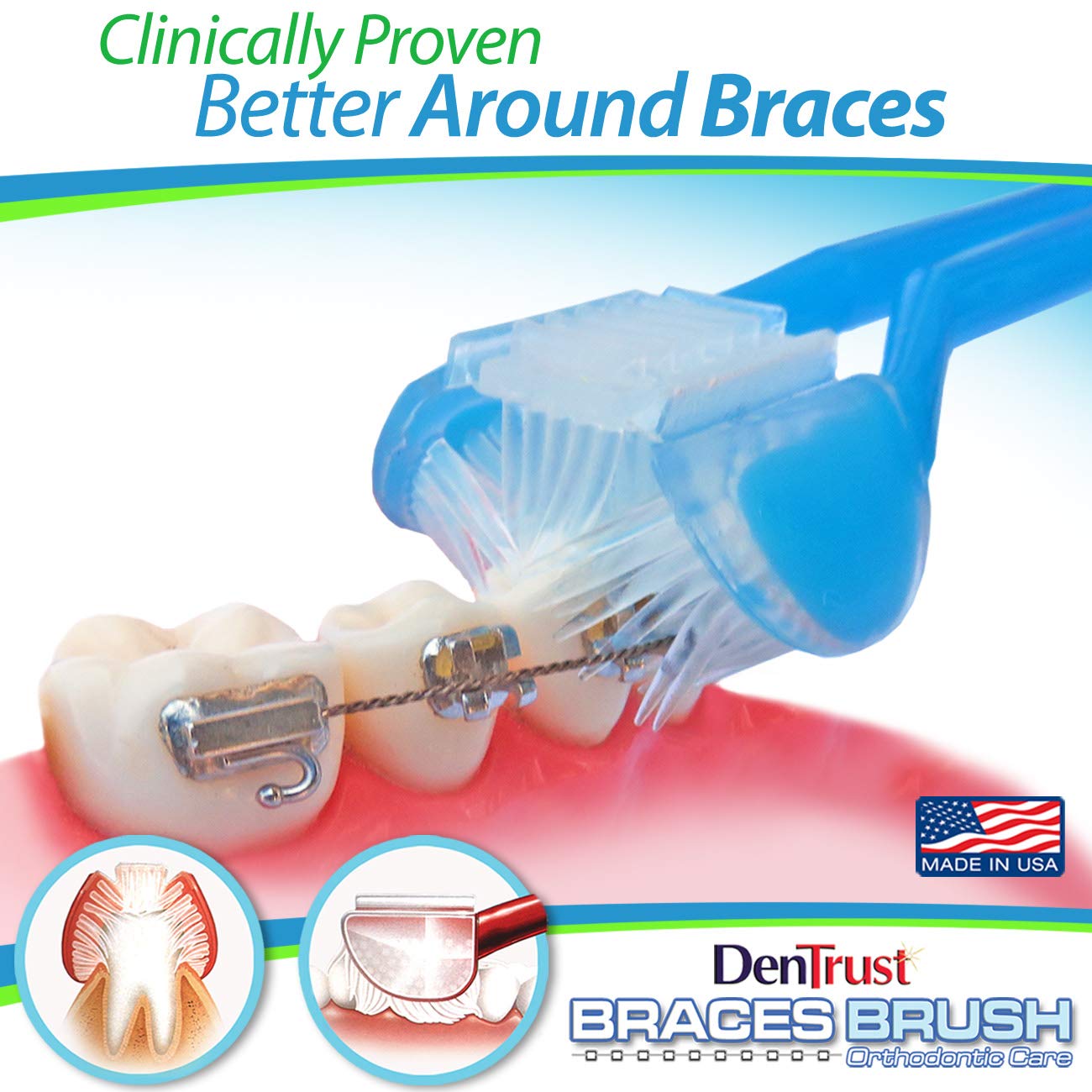 DenTrust | Braces Brush 3-Sided Toothbrush | Cleans Better Around Orthodontic Brackets | Fun & Easy to Use for All Kids | Tongue Cleaner for Fresh Breath | Made in USA