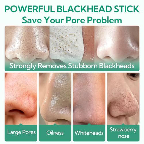 BREYLEE Blackhead Remover Mask, Tea Tree Oil Nose Pore Strips +100 papers, Puntos Negros, Peel Off Mask for Nose and Face, Pore Cleanser Purifying, Brush Desigh