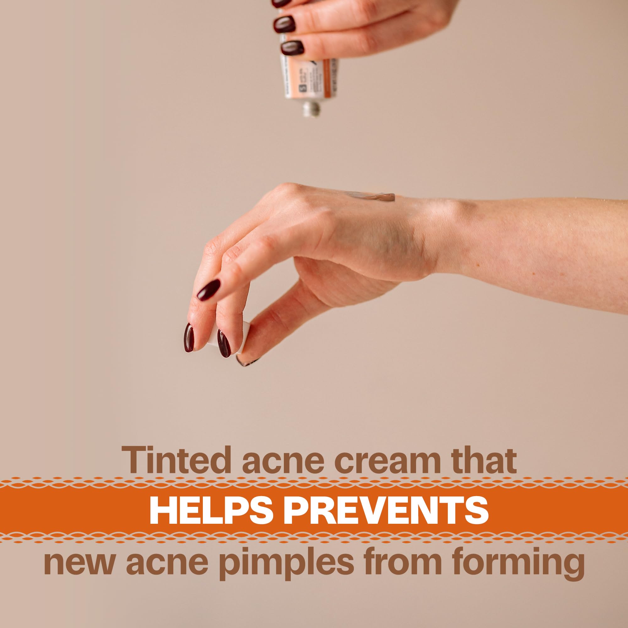 Adult Acnomel Acne Medication Cream, 1.3 Ounces