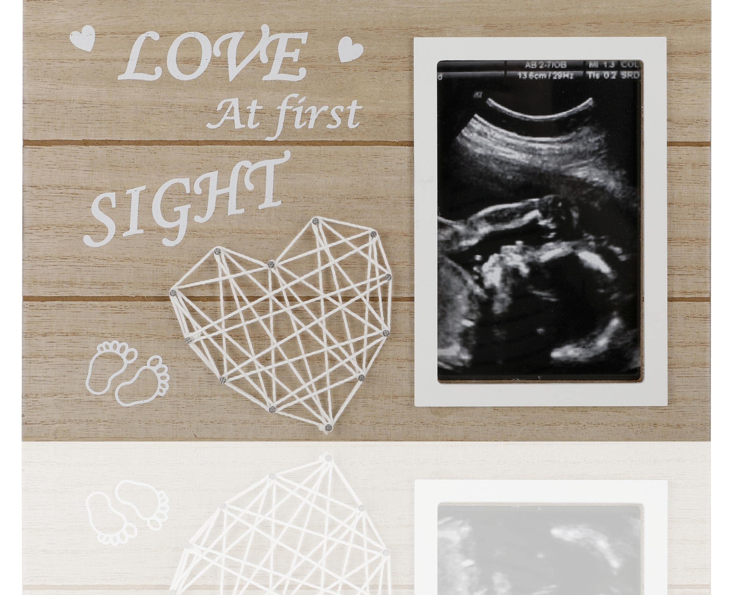Sonogram Picture Frame - First Time Parents Gifts - Keepsake Baby Ultrasound Frame - Expecting Parents Gift - Baby Shower - Love at First Sight - Pregnancy Gifts For First Time Moms – Nursery Decor