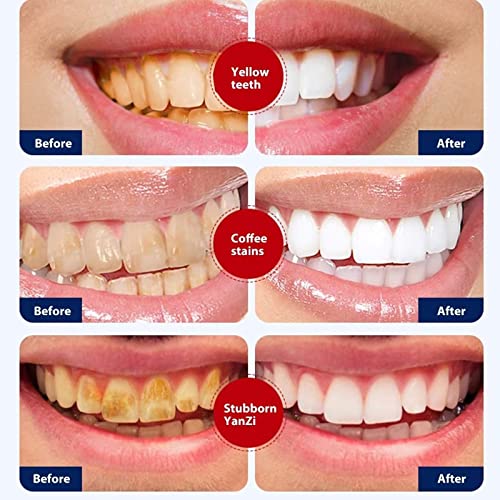 28Pcs Teeth Whitening Strips, Express for White Strips, No Slip and No Sensitivity, Enamel Safe Dental Whitener Kit