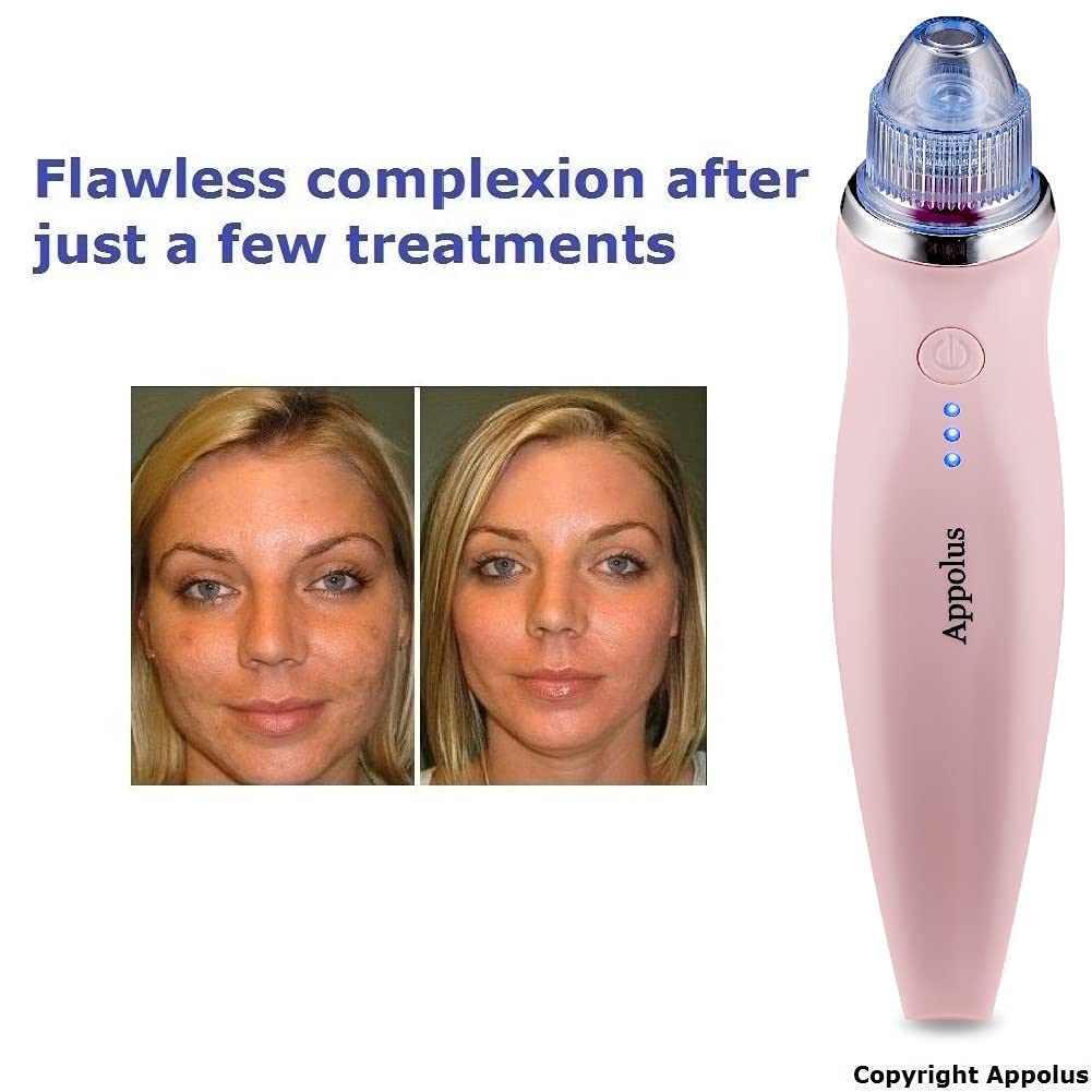 Microdermabrasion Machine - Appolus Premium Diamond Microdermabrasion Device for Flawless Glowing Skin - 2 Diamond Tips - 5 Heads - Anti-Aging - Pore Lines Wrinkles Sagging Minimizer
