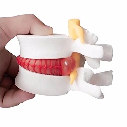 BoNew-Oral 1:1.5 Anatomical Human Lumbar Vertebrae Degenerative Lumbar Human Spine Model White Color