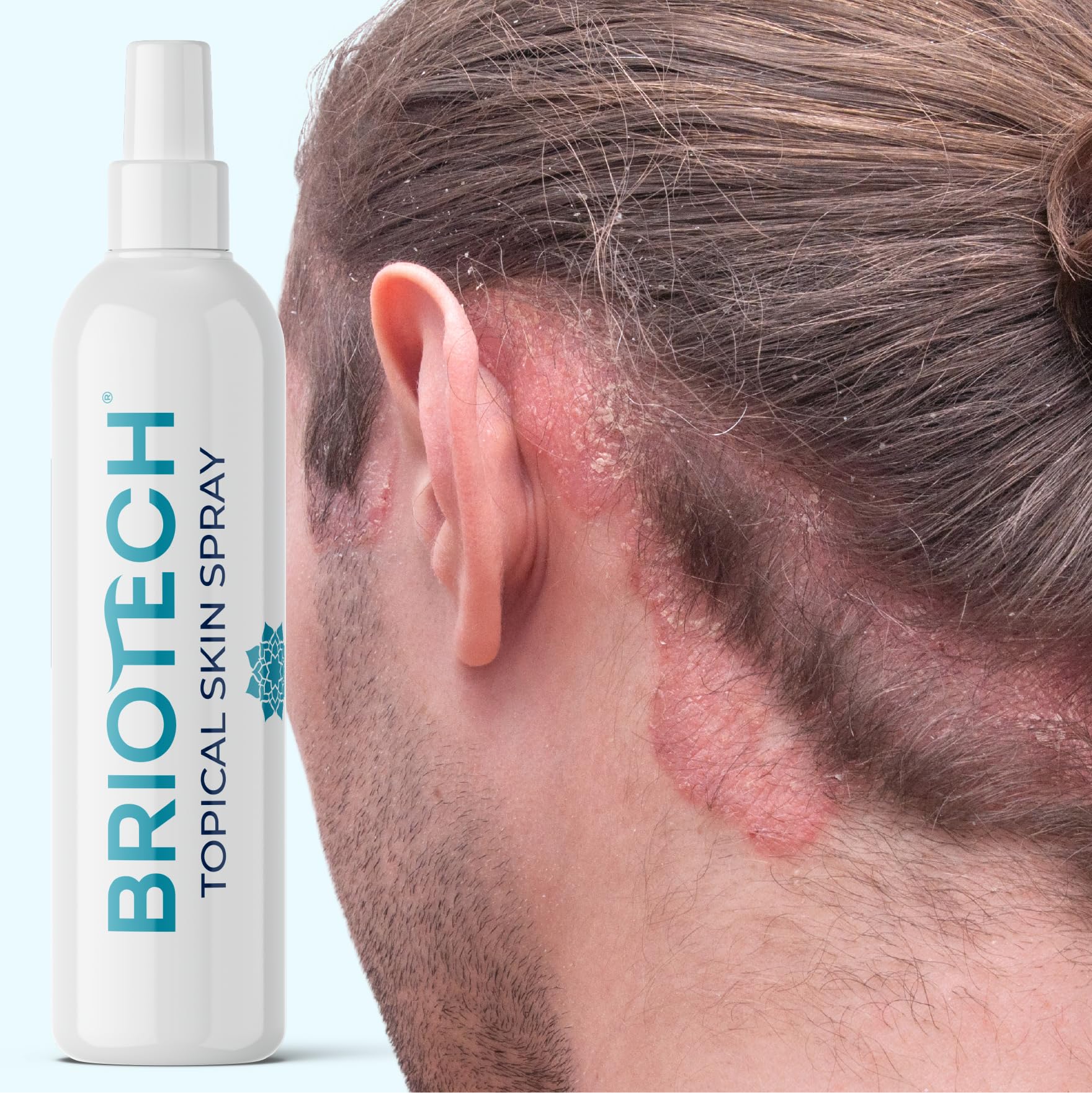 BRIOTECH Topical Skin Spray, Hypochlorous Acid Spray for Body & Face, Eyelid Cleanser, HOCl Facial Mist, Support Against Irritation and Redness, Stocking Stuffers, Packaging May Vary, 4 oz, 1 ct