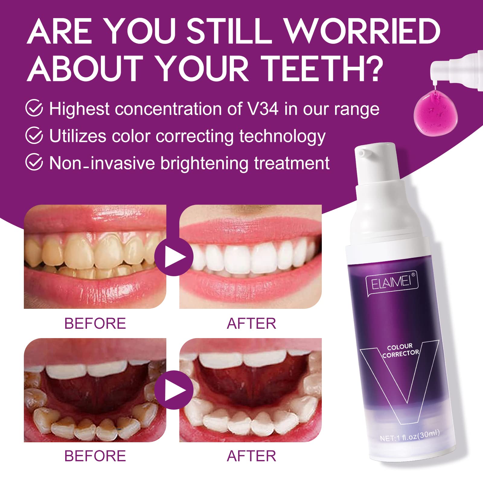 1Pcs Colour Corrector Purple Teeth Whitening Sensitive Teeth Toothpaste,Tooth Stain Removal, Teeth Whitening Booster,Not Causing Sensitivity 30ml