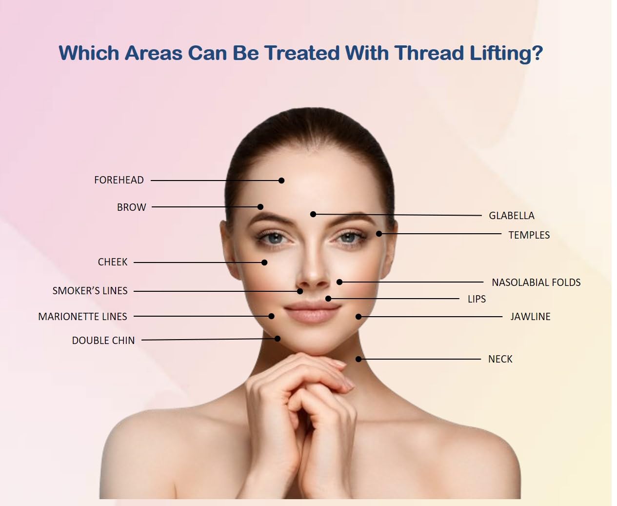 ACE - Multi Thread/L Cannular PDO thread for Forehead/Nose/Nasolabial Folds (23G38/50mm)