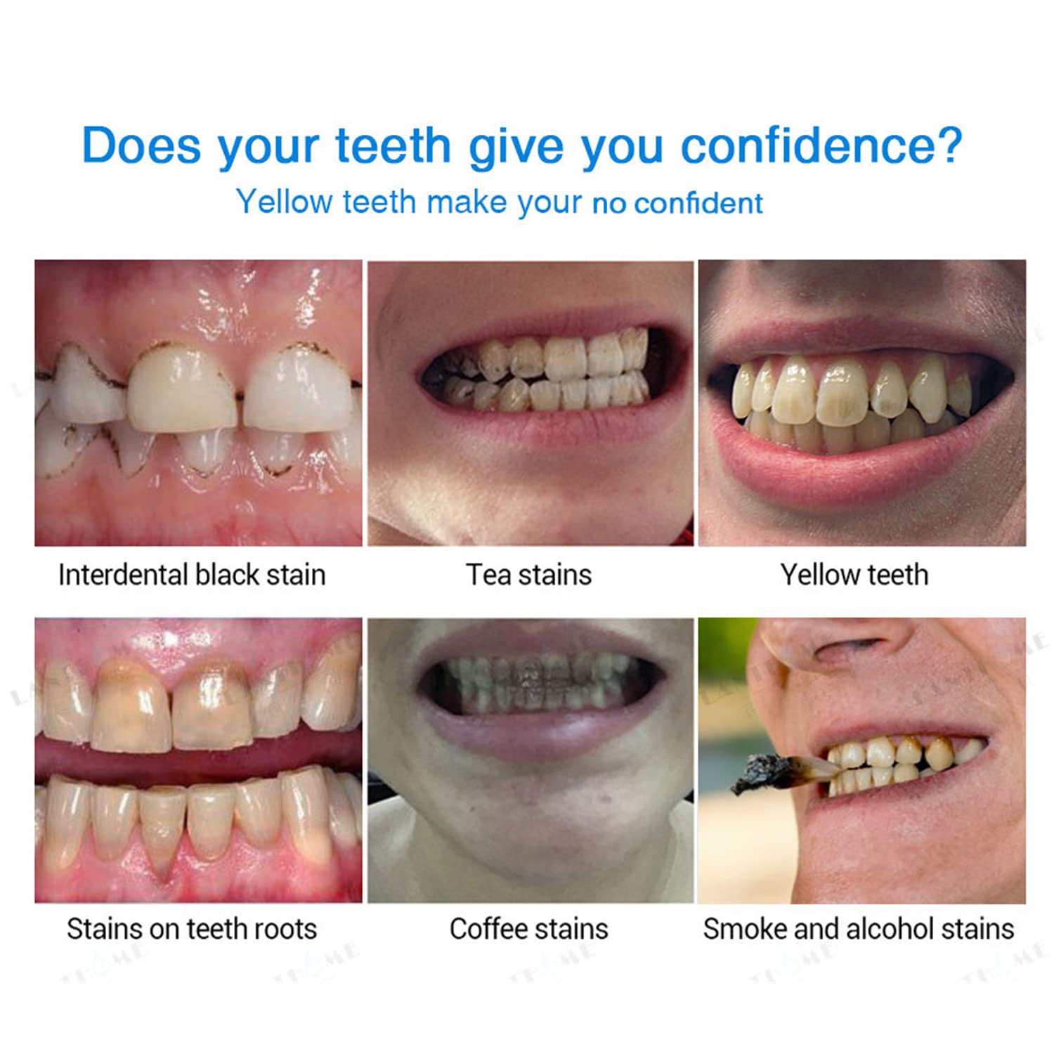 3PCs Frosty Neptune Teeth Whitening Pen,Teeth Whitening Essence,Teeth Whitening Gel,Teeth Stain Remover to Whiten Teeth,Intensive Stain Removal Teeth Reduce Yellowing