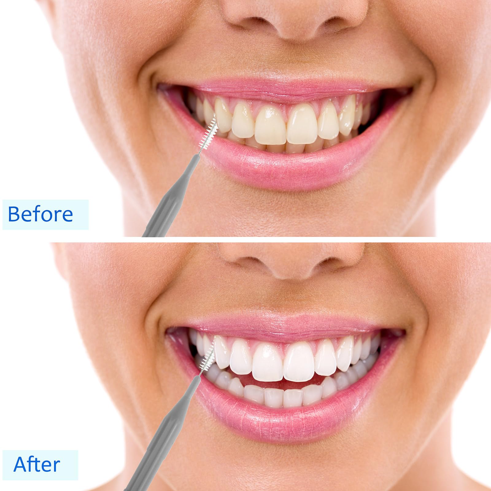 Patelai 100 Pieces Braces Brush for Cleaner Interdental Brush Toothpick Dental Flossing Head Oral Hygiene Flosser Tooth Cleaning Tool (Stylish Colors)
