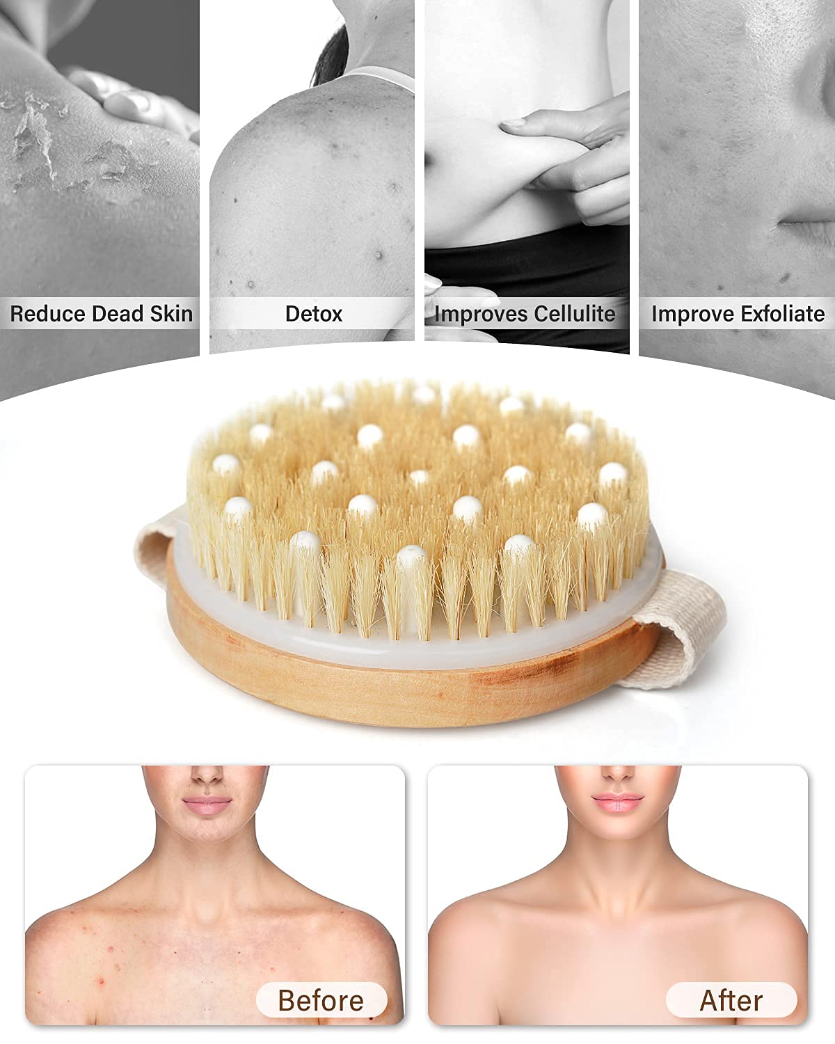 Dry Brushing Body Brush, POPCHOSE Exfoliating Body Brush for Beautiful Skin, Body Scrubber for Cellulite and Lymphatic Drainage, Blood Circulation Improvement with Natural Bristles Massage Nodules
