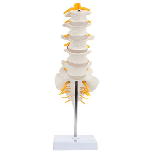 Axis Scientific Lumbar Spine Anatomy Model with Sacrum and Spinal Nerves, Lumbar Vertebrae, Vertebral Model, Spinal Model Didactic Replica of Lumbrosacral Section with Nerves, Herniated Disc at L4, Includes Base for Display