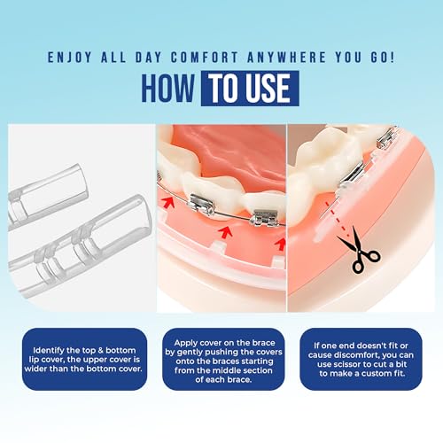Comfort Cover Braces Guard/Lip and Mouth Protector - Snap on Cover Strip for Braces - Orthodontic/Dental Quality (Clear)