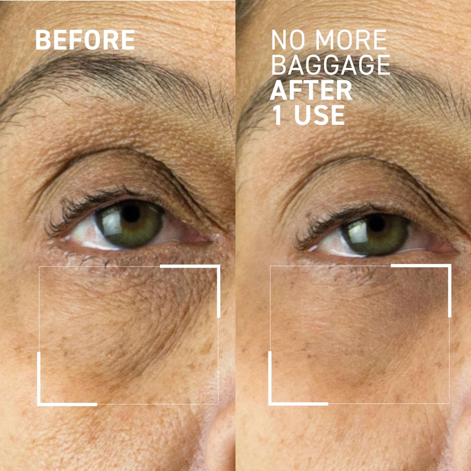 Dr. Brandt Skincare needles no more NO MORE BAGGAGE eye de-puffing gel TRAVEL SIZE, 7 g.