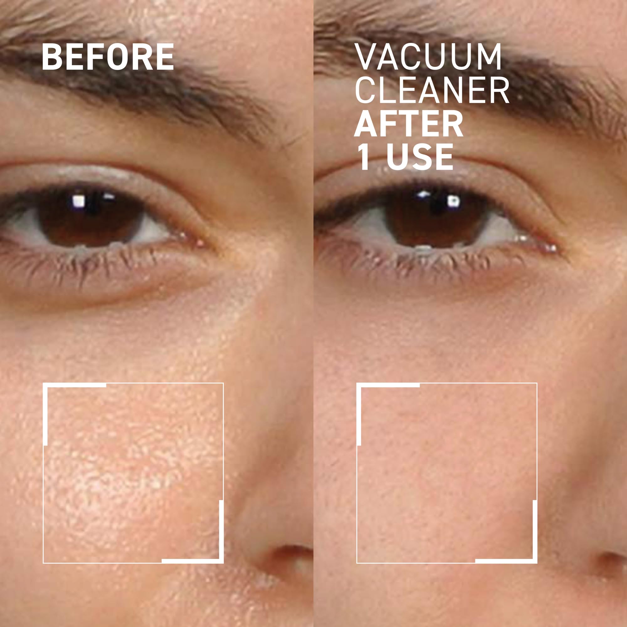 Dr. Brandt Pores No More Vacuum Cleaner - Pore-Purifying Mask to Unclog & Shrink Pores - 1 oz