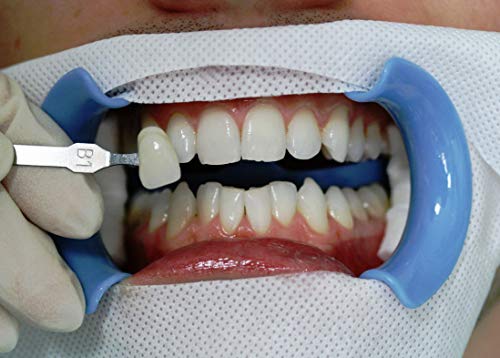 BEYOND FLEXIBLUE Comfort Cheek Retractors | Disposable Dental Cheek Retractors | Plastic Mouth Opener - Medium 10pk