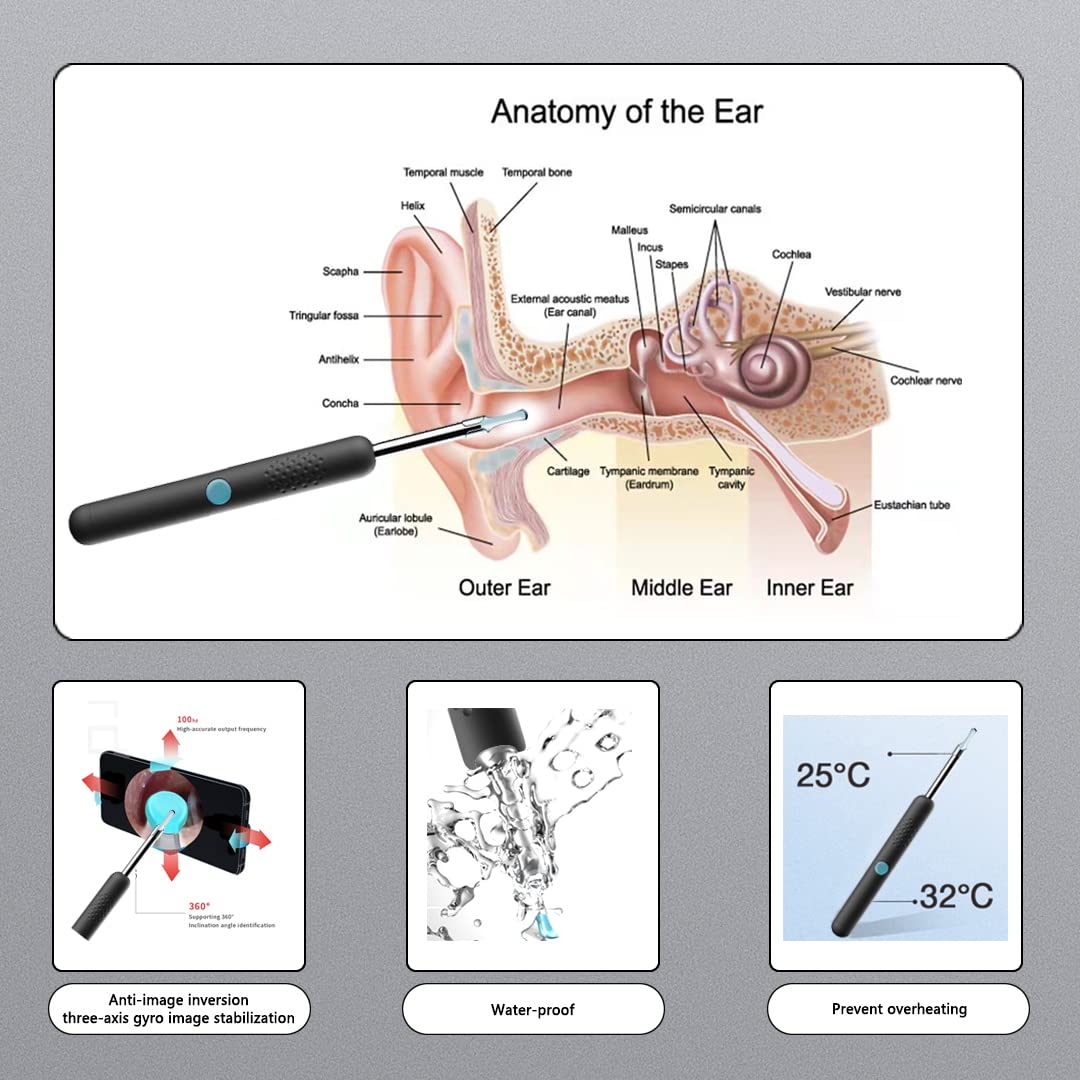 Oxbird(200-300W-PX) HD Wireless Otoscope with Light Ear Wax Camera, Ear Wax Remover Removal Cleaner Cleaning Kit, Suitable for Apple/Android, Dad and Madam Artifact,Perpetual Commitment