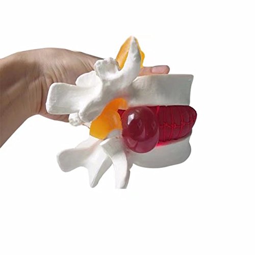 BoNew-Oral 1:1.5 Anatomical Human Lumbar Vertebrae Degenerative Lumbar Human Spine Model White Color