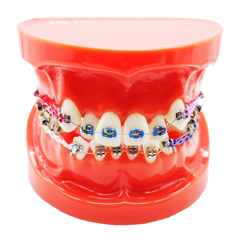 Dental Typodont With Metal Brackets Orthodontic Teeth Model With Ligature Ties Red